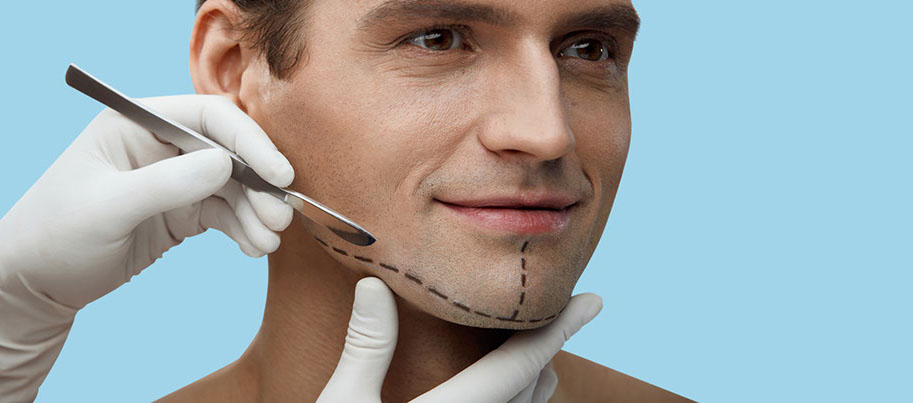 Implante de menton, Dr. Emilio Mont Cirujano Plástico